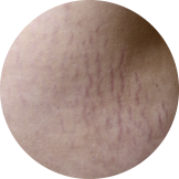 Striae-Rubra - Stratamark.net