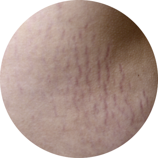 Striae-Rubra - Stratamark.net